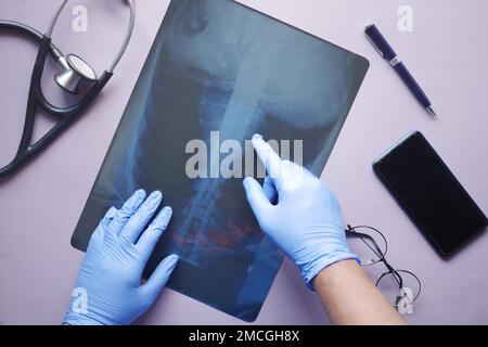 doctor hold analyzing xray photography, closeup Stock Photo - Alamy