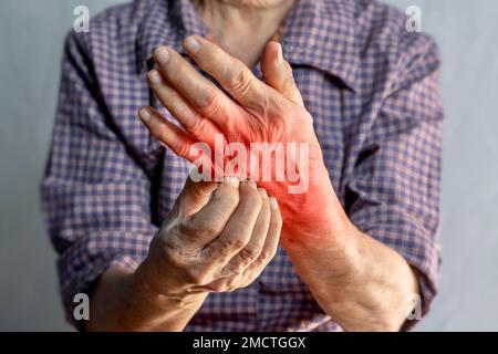 Asian elder woman scratching her arm. Concept of itchy skin diseases ...