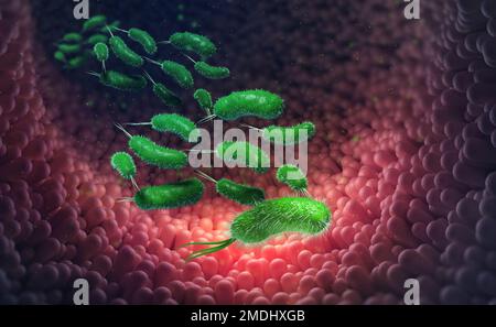 Bowel infection, upset stomach, germs and viruses in body. Intestinal ...