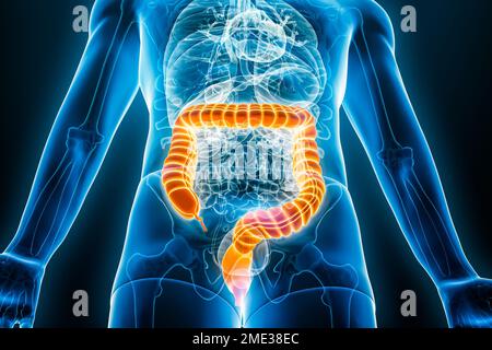 An anterior view of the large intestine and colon, with a flexible ...
