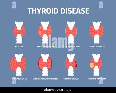 Thyroid gland with goiter body organ outline icon Stock Vector Image ...