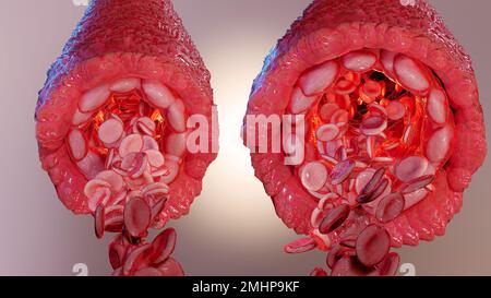 Vasodilation and vasoconstriction. Comparison of Blood vessels, 3d ...
