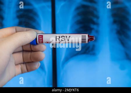 Blood collection tubes Respiratory syncytial virus(RSV) test positive ...