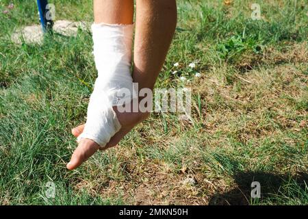 Children's legs are bandaged in plaster - barefoot on a swing ...