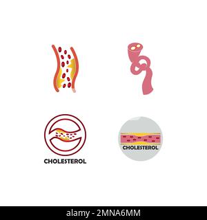 vector of cholesterol plaque illustratrion design Stock Photo - Alamy