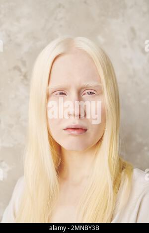 Serene albino girl with long hair holding bunch of dried flowers while ...