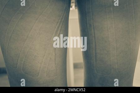 Marks on the bum legs of a woman from the chair Stock Photo - Alamy