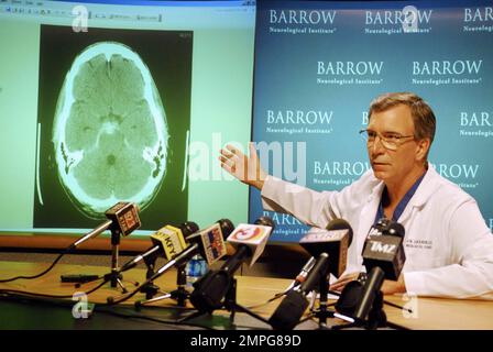 Dr Joseph Zabramski of the Barrows Neurological Institute at St Josephs ...