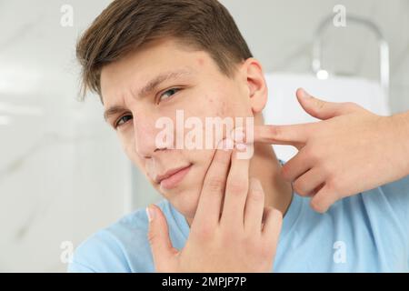 Teen guy with acne problem squeezing pimple on light blue background ...