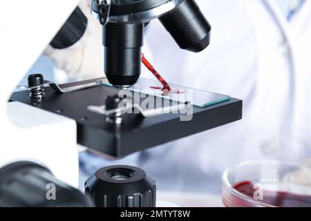 Scientist dripping blood sample onto slide on microscope in laboratory ...