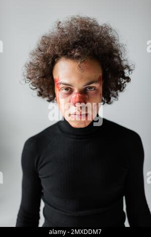 young african american man with bleeding face and broken nose holding ...