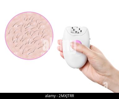 Epilation procedure. Woman holding modern appliance near illustrations ...
