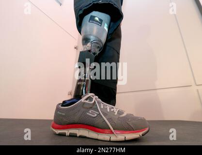 Wolfgang Rangger present his sentient artificial leg in Vienna, Austria ...