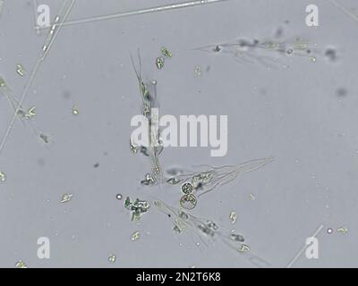Diatoms, algae under microscopic view, phytoplankton, fossils, silica ...