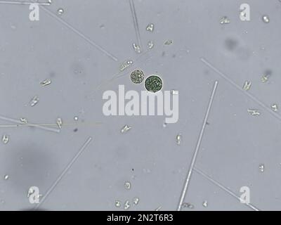 Diatoms, algae under microscopic view, phytoplankton, fossils, silica ...