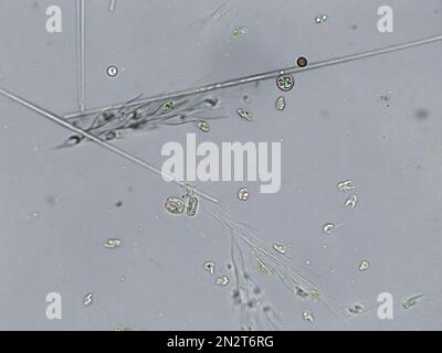 Diatoms, algae under microscopic view, phytoplankton, fossils, silica ...