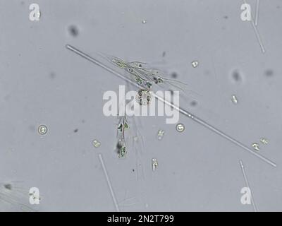 Diatoms, algae under microscopic view, phytoplankton, fossils, silica ...