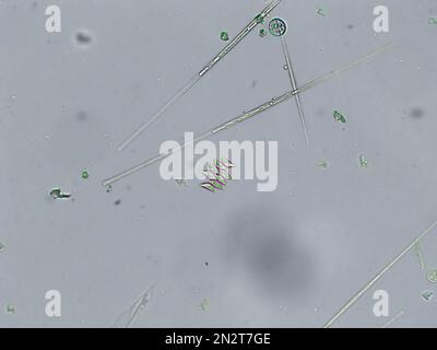 Diatoms, algae under microscopic view, phytoplankton, fossils, silica ...