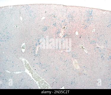 Low magnification micrograph of a liver showing Kupffer cells labelled ...