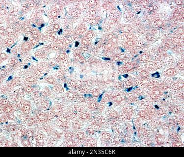 Liver Kupffer cells are macrophages related to the liver sinusoids ...
