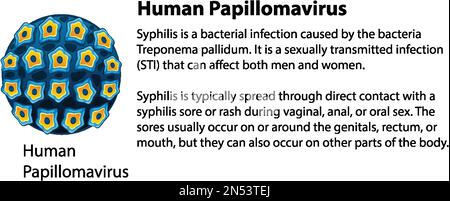 Human Papillomavirus with explanation illustration Stock Vector Image ...