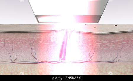 Skin tissues cross-section illustration. Extracellular matrix structure ...