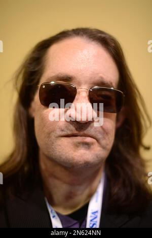 The nation's first full face transplant patient Dallas Wiens receives a ...