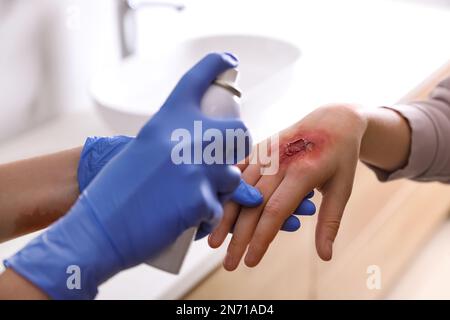 Applying burn spray onto injured skin, closeup Stock Photo - Alamy