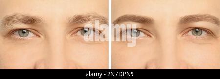 man male eyes eyebrow monobrow forehead vision sight see ocular ...