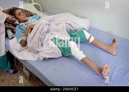Fifteen year-old Sahar Gul, shows her hand displaying a finger where he ...