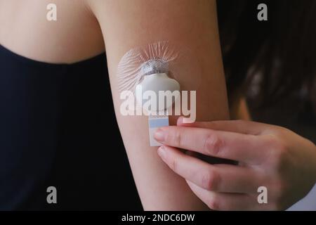 Inserted blood glucose sensor with transmitter and adhesive sticker ...