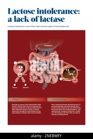 Infographic of the large intestine and small intestine of the digestive ...