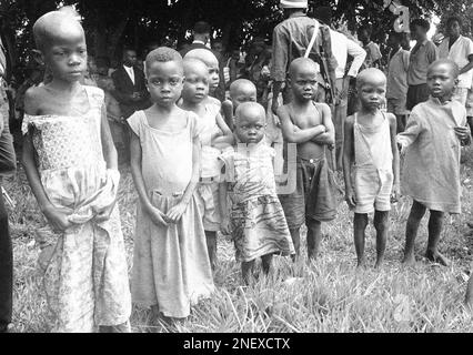 Terrible scenes of starving children at the hospital in Bakwanga, South Kasai, Congo on Dec. 28 ...