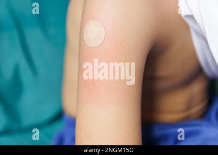 Local reaction to vaccine in children Stock Photo - Alamy
