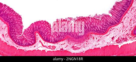 Human appendix section, vermiform appendix Stock Photo - Alamy