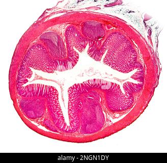 The cecum or caecum is a pouch within the peritoneum that is considered ...