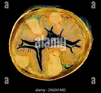 The cecum or caecum is a pouch within the peritoneum that is considered ...