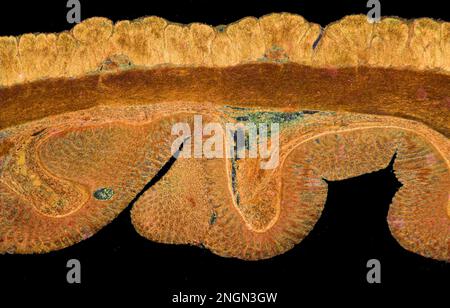 Human COLON SECTION, brightfield photomicrograph Stock Photo - Alamy