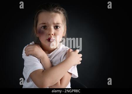 Little girl with bruises on face against dark background, space for ...