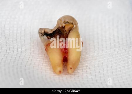 Close up decayed tooth on white background Stock Photo - Alamy