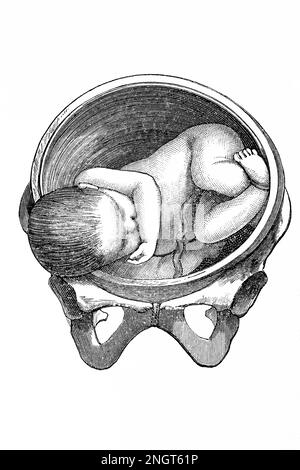 Next birth. Baby inside the womb with transverse position Stock Photo ...