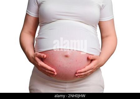 Acne on the stomach of a pregnant woman, home living room Stock Photo ...