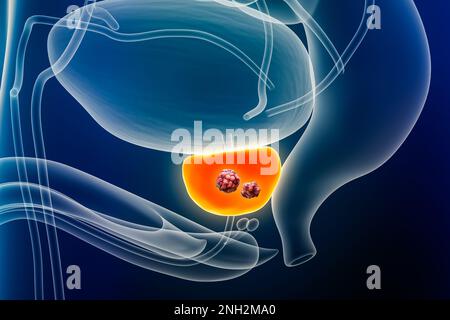 Xray prostate organ 3D rendering illustration with male body contours ...