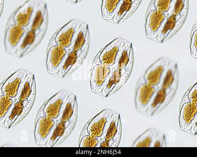 Amphora sp. algae under microscopic view, Diatoms, phytoplankton ...