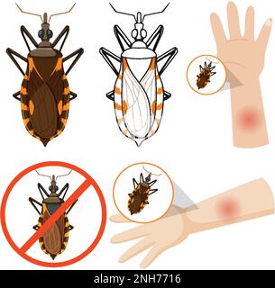 Human arm swollen from kissing bug bite illustration Stock Vector Image ...
