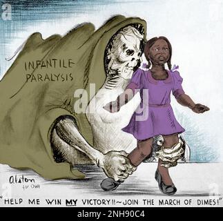 Illustration of paralysis due to polio. From "Observations on states of ...