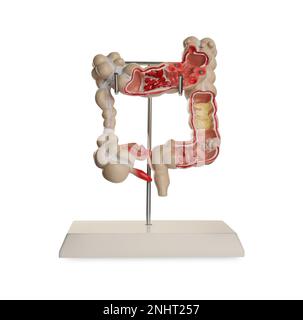Anatomical model of large intestine on white background, collage ...