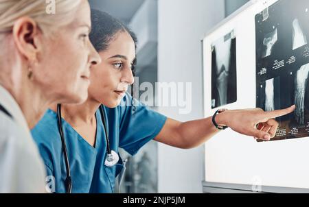 Medical, x ray and surgery with doctors planning in meeting for mri scan, strategy or research ...