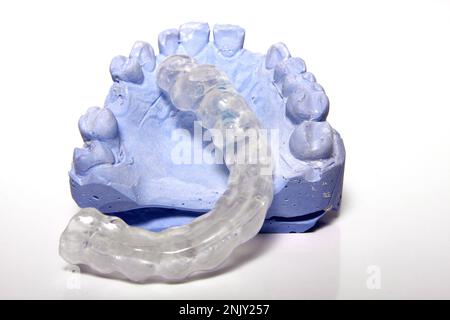 denture impressions with grinding splint, dental bridge and crown Stock ...