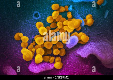 Colorized electron microscope image of yellow fever virus ...